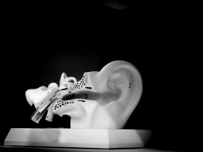 Otosclerosis - Aesthetic Face Istanbul